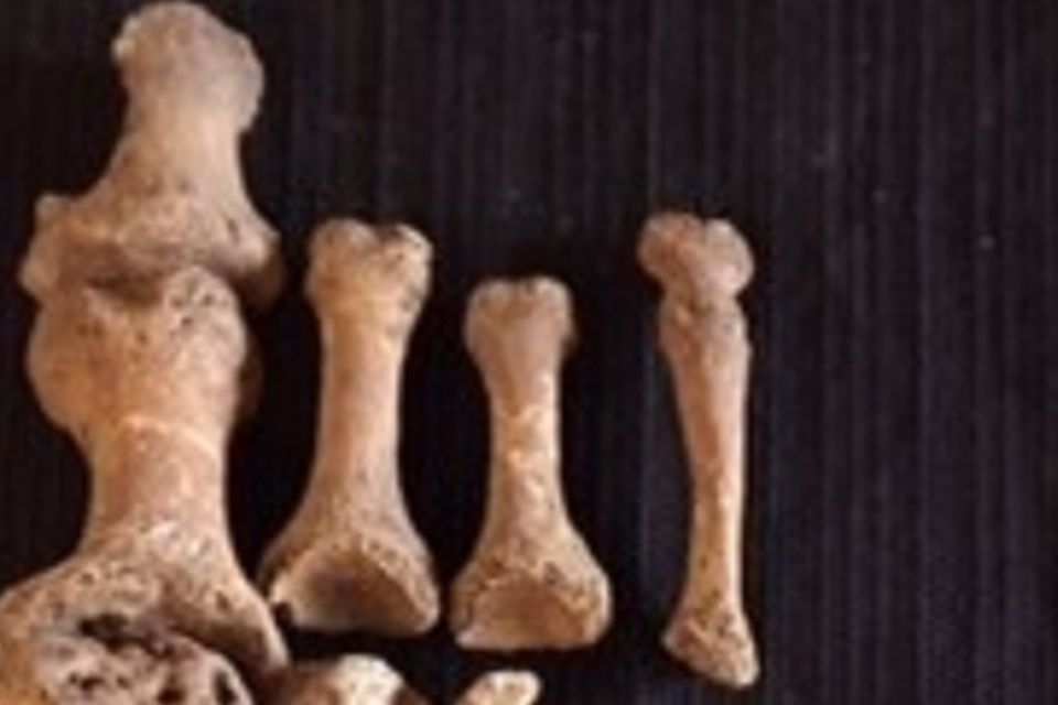 Skeleton 'hints at leprosy history' | BelfastTelegraph.co.uk