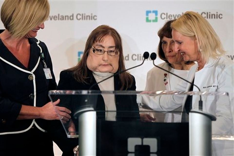 First US face transplant patient reveals face | BelfastTelegraph.co.uk