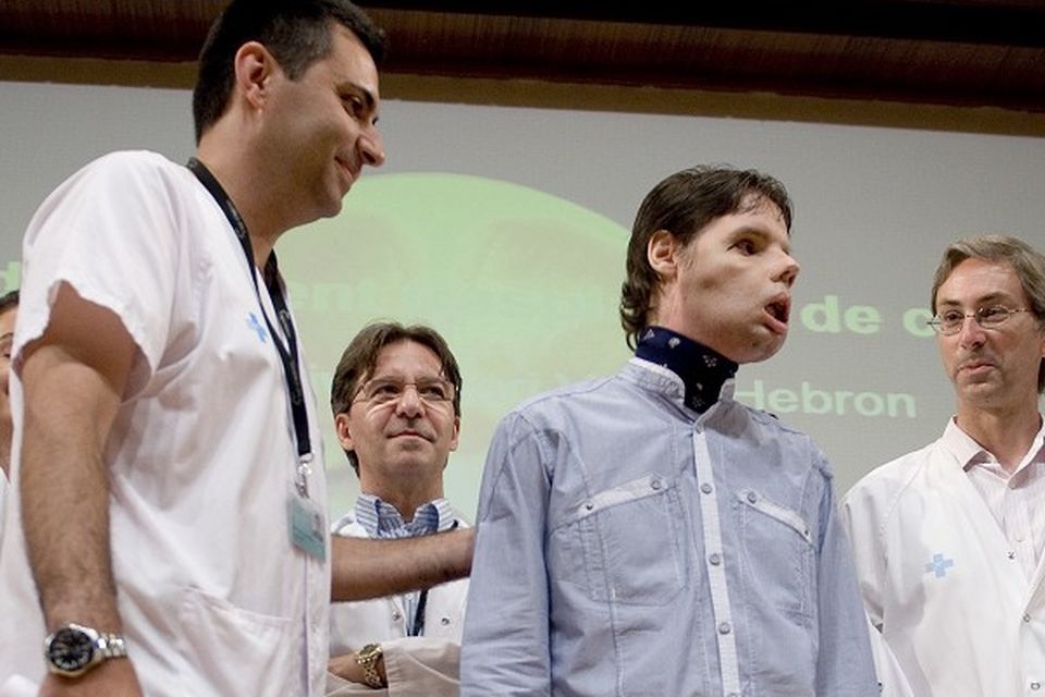 First full-face transplant patient reveals new face? | BelfastTelegraph ...