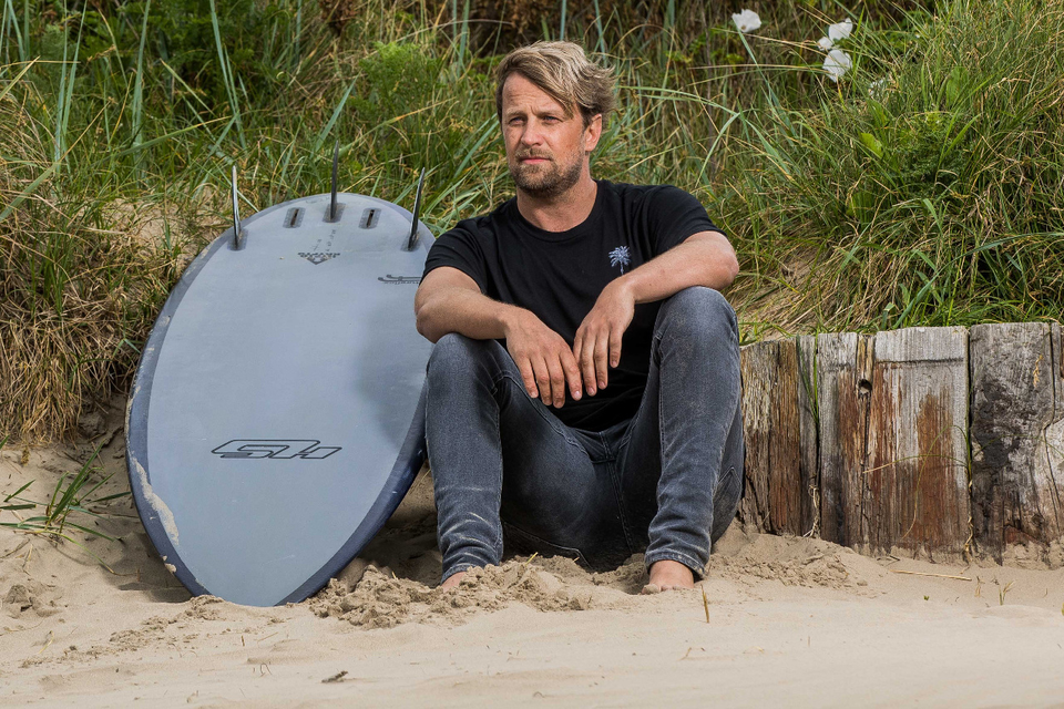 Kian Egan Hair Loss